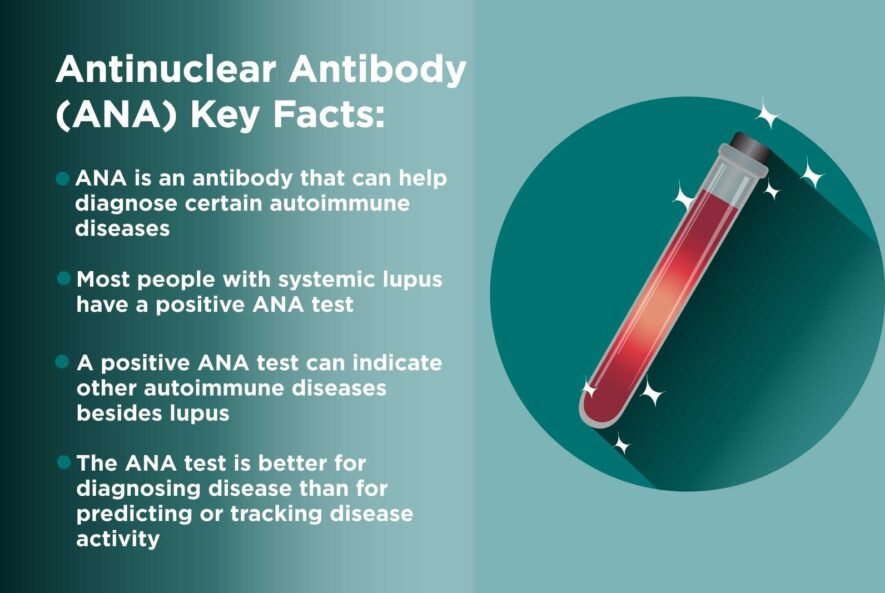 ANTI NUCLEAR ANTIBODIES (ANA) – Thyrocare Aarogyam centre/Diagnostic ...